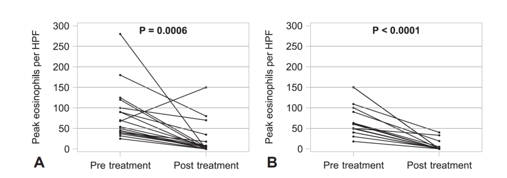 Oral Viscous Mometasone: Is this a more effective swallowed steroid ...